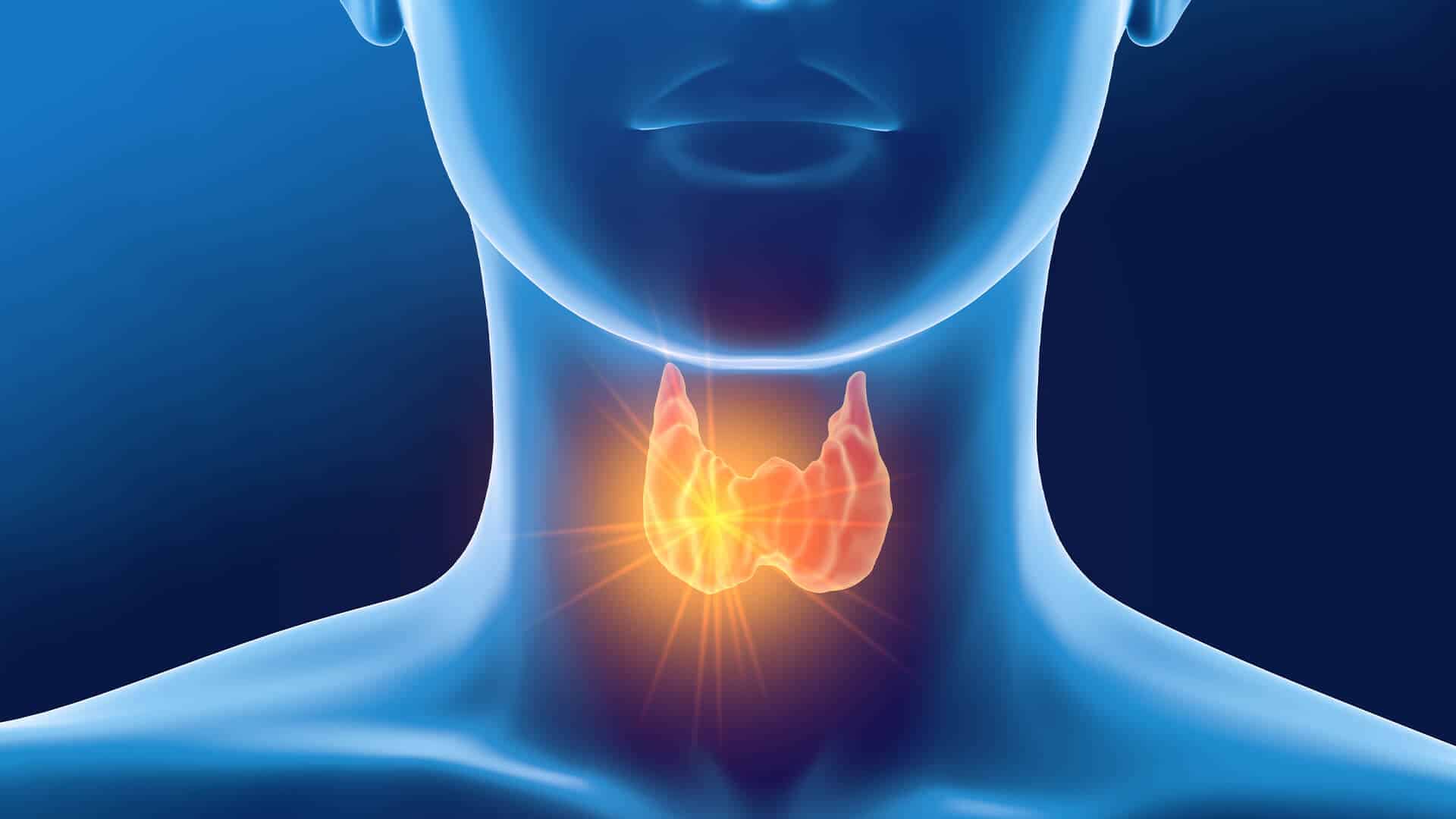 Hyperthyroidism - topchiro.co.uk