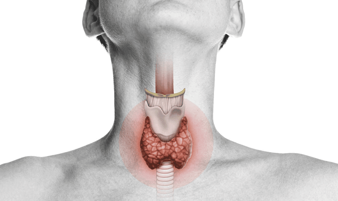Hypothyroidism - topchiro.co.uk